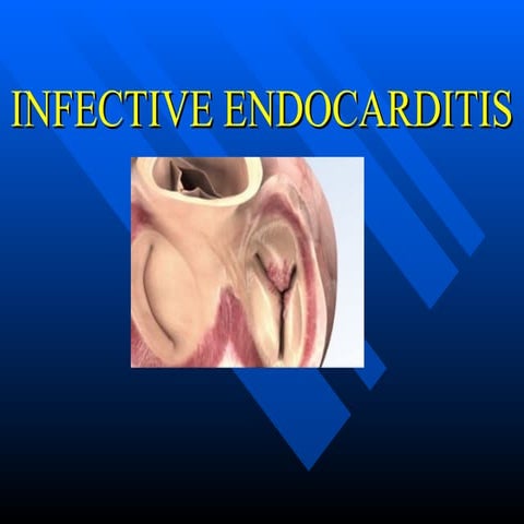 infectiveendocardits PATHOPHYSILOGY AND TREATMENT.ppt