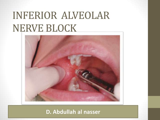 Inferior Alveolar Nerve Pptx