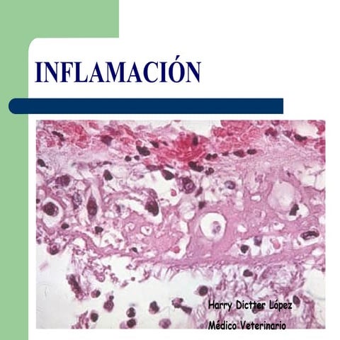 SISTEMA INMUNOLOGICO IMPACTO DE LA INFLAMACIÓN.ppt