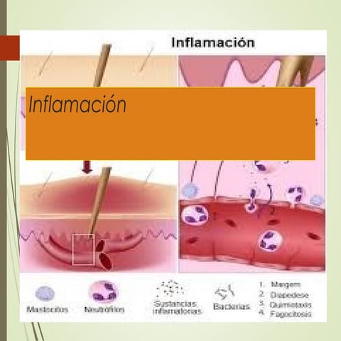 Inflamacion | PPT