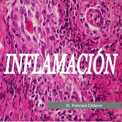 Inflamación | PPT