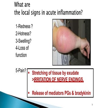 inflammation.pptx