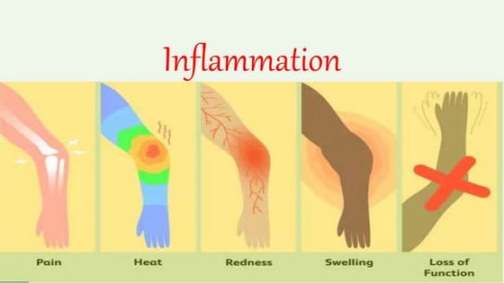 Cardinal signs of_inflammation (1) | PPTX | Heart and Cardiovascular ...