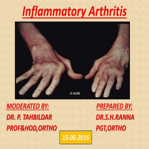 Inflammatory arthritis | PPTX