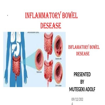 Crohn's Disease.pptx