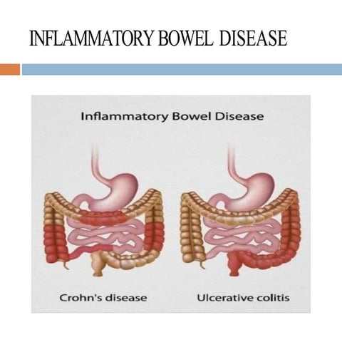 inflammatory bowel diseas.pptx