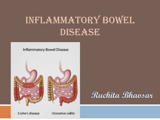 Inflammatory bowel disease | PPT