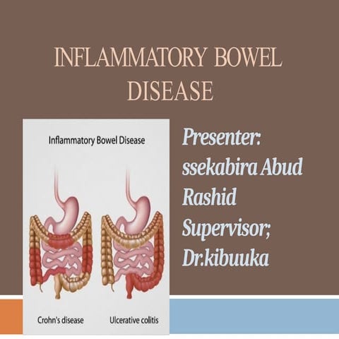 Inflammatory bowel disease | DOCX