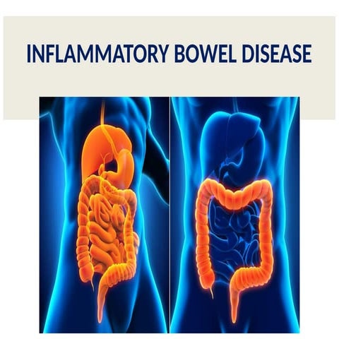 Inflammatory Bowel Disease | PDF