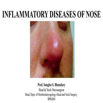 INFLAMMATORY DISEASES OF NOSE (INCLUDING Atrophic rhinitis, Allergic ...