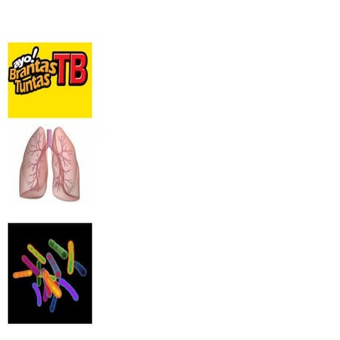 INFO DASAR TB yang berbahaya dan perlu di perhatikan .pptx