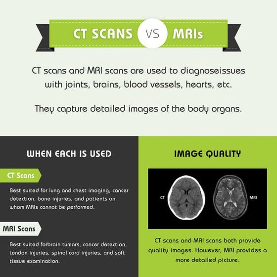 An Explanation Of The Differences Between An MRI And a CT Scan | PDF ...