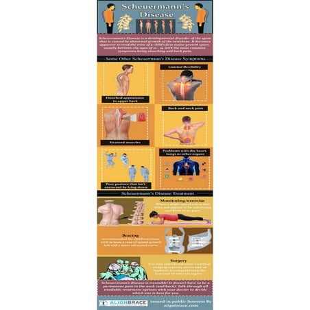 Scheuermann’s Disease - A Developmental Disorder of the Spine | PDF ...