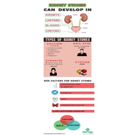 Kidney Stones Can Develop In | PDF