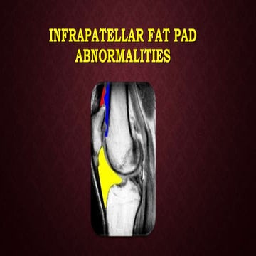Infrapatellar fat pad abnormalities | PPTX