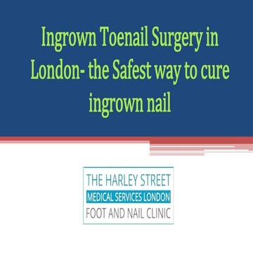 Ingrown Toenail Surgery in London- the Safest way to cure ingrown nail ...