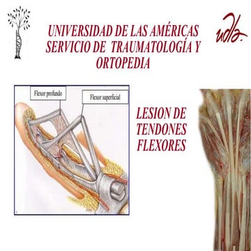 Reconstruccion de lesiones de tendones extensores | PPTX