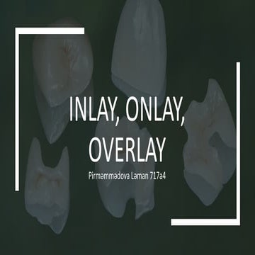 inlay onlay overlay.pptx