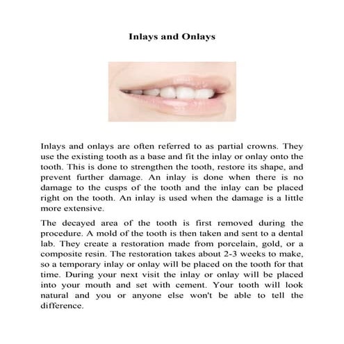 Inlays and onlays | PPT