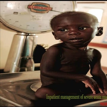 malnutrition (MAM and SAM ) in pediatrics.pptx