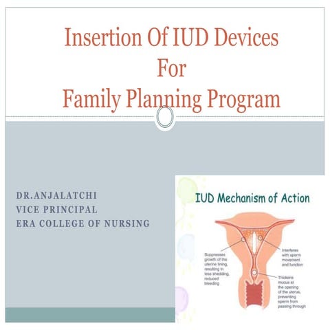 insertion of IUD devices.pptx