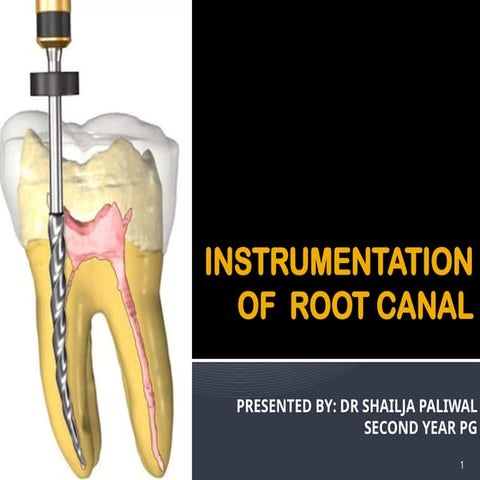 INSTRUMENTATION-OF-THE-ROOT-CANAL-pptx.pptx
