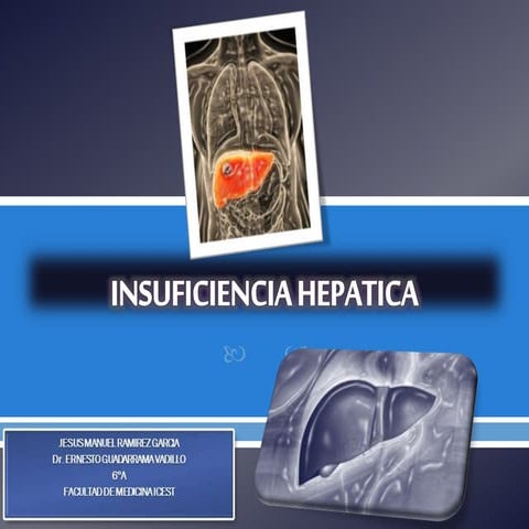 Insuficiencia hepatica | PPTX