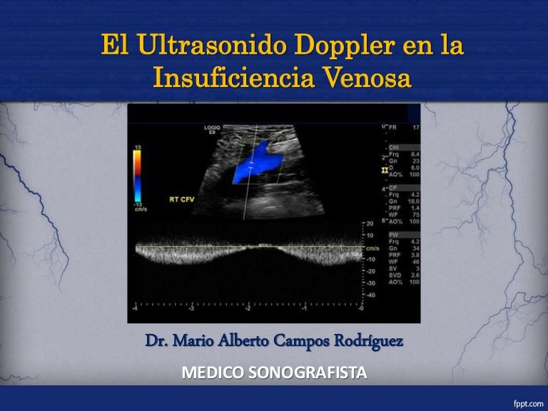 La Ecografía Doppler En La Insuficiencia Venosa