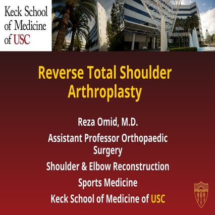 reverse Shoulder presentation.pdf