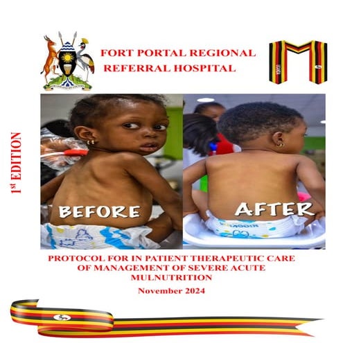 INTEGRATED MANAGEMENT OF ACUTE MALNUTRITION (IMAM) 1st EDITION NOVEMBER ...