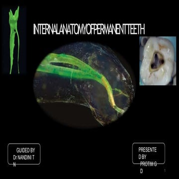 Anatomy of pulp chamber | PPTX