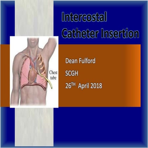 Intercostal Drainage Tube | PPTX