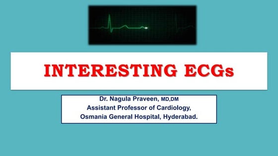 P wave abnormalities in ECG | PPSX | Heart and Cardiovascular Diseases | Diseases and Conditions