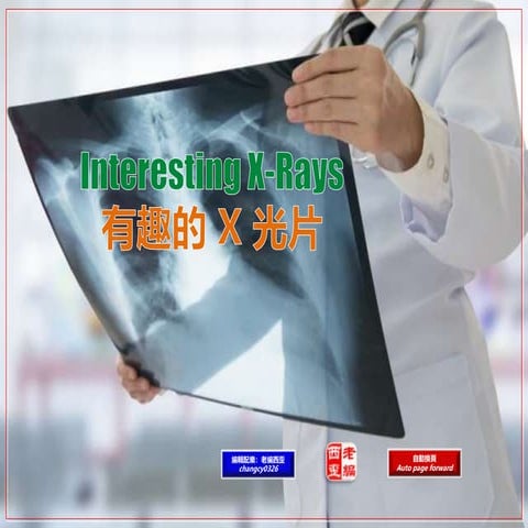 Interesting X-Rays (有趣的 X 光片).ppsx