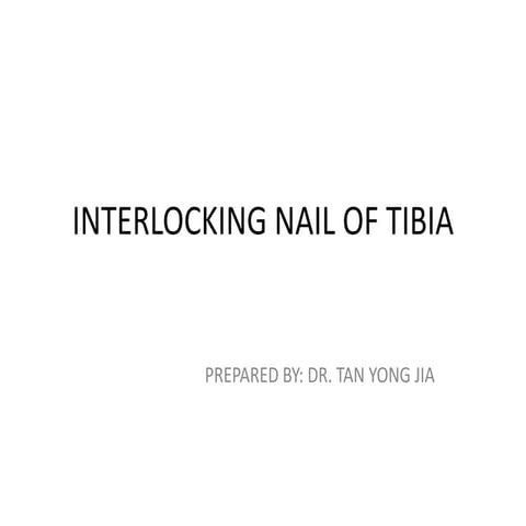 Interlocking nail of tibia | PPTX