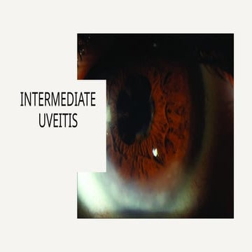 INTERMEDIATE UVEITIS FINAL.pptxxxxxxxxxx | PPTX