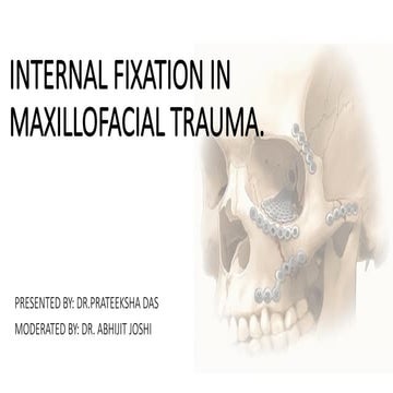 Hardware in maxillofacial trauma | PPTX