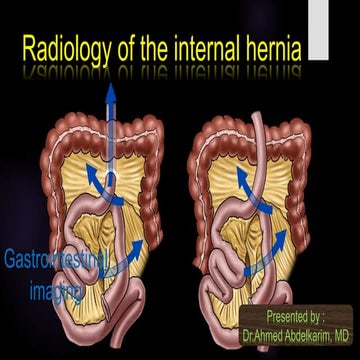 Internal hernia radiology by Dr. Abdelkarim.pdf