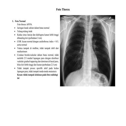 Bahan Thorax Normal untuk radiologi pptx | PPTX