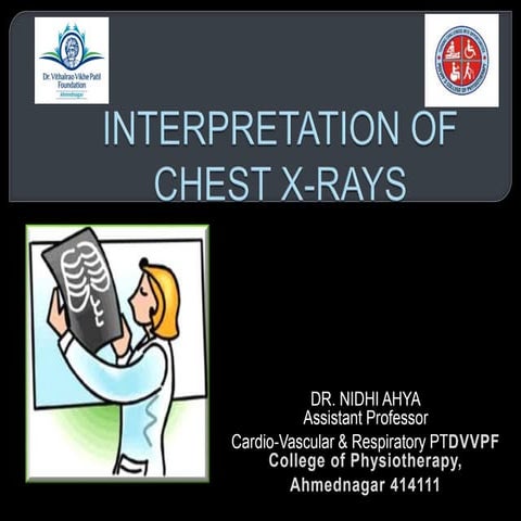 Interpretation of chest x-rays | PPTX