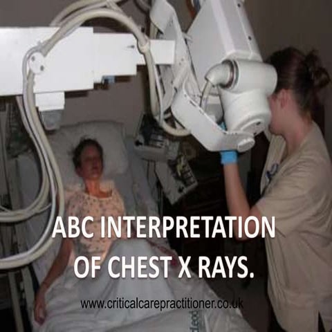 The structured interpretation of chest x rays. | PPTX