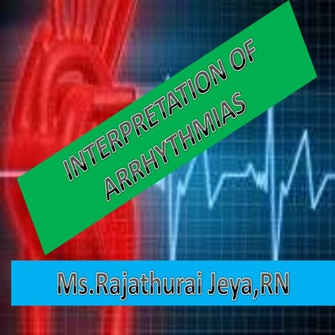 Interpretation of arrhythmias | PPTX