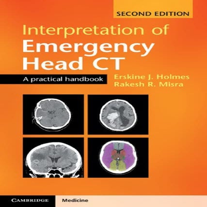 Interpretation of emergency head ct | PDF