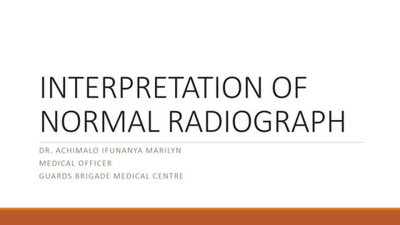 Radiology of nose and paranasal sinuses | PPTX