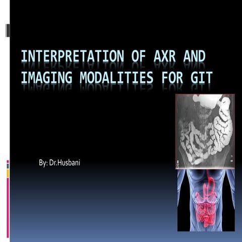 Abdominal x ray . axr | PPTX