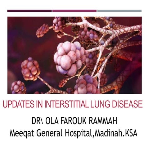 Interstitial lung fibrosis diseases | PPTX