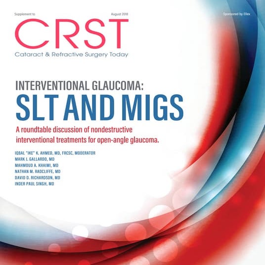 Interventional Glaucoma: SLT and MIGS | PDF