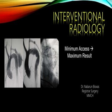 Interventional radiology | PPTX