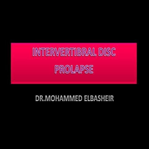 Intervertebral disc prolapse(ivdp) | PPTX