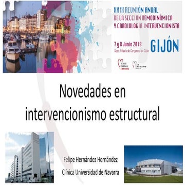 Intervencionismo estructural | PDF